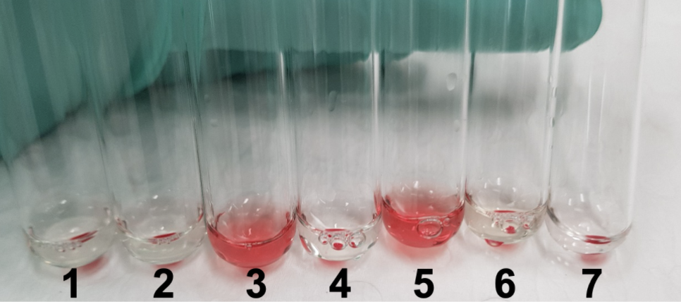 Solved Based on the above image, match each Coombs tube | Chegg.com