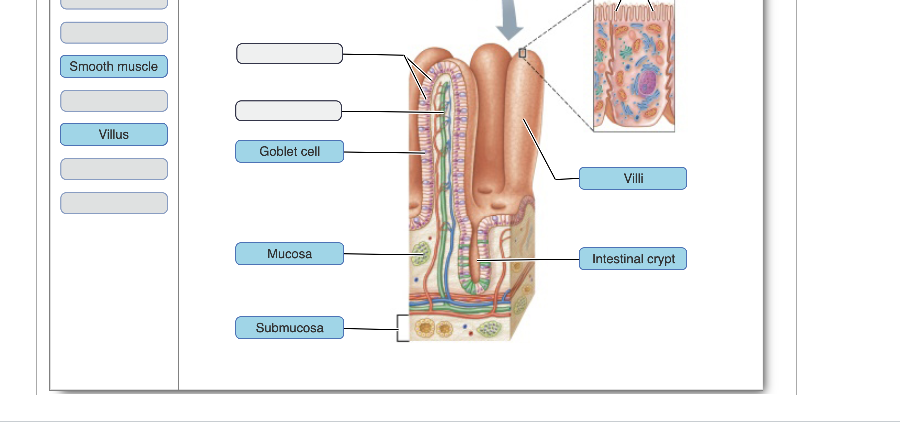Solved The results of the endoscopic biopsy revealed | Chegg.com