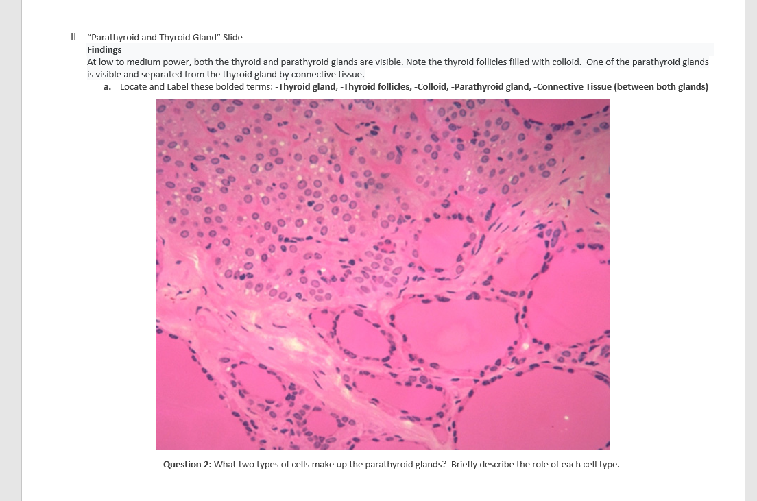 Solved “Parathyroid and Thyroid Gland” Slide Findings At | Chegg.com
