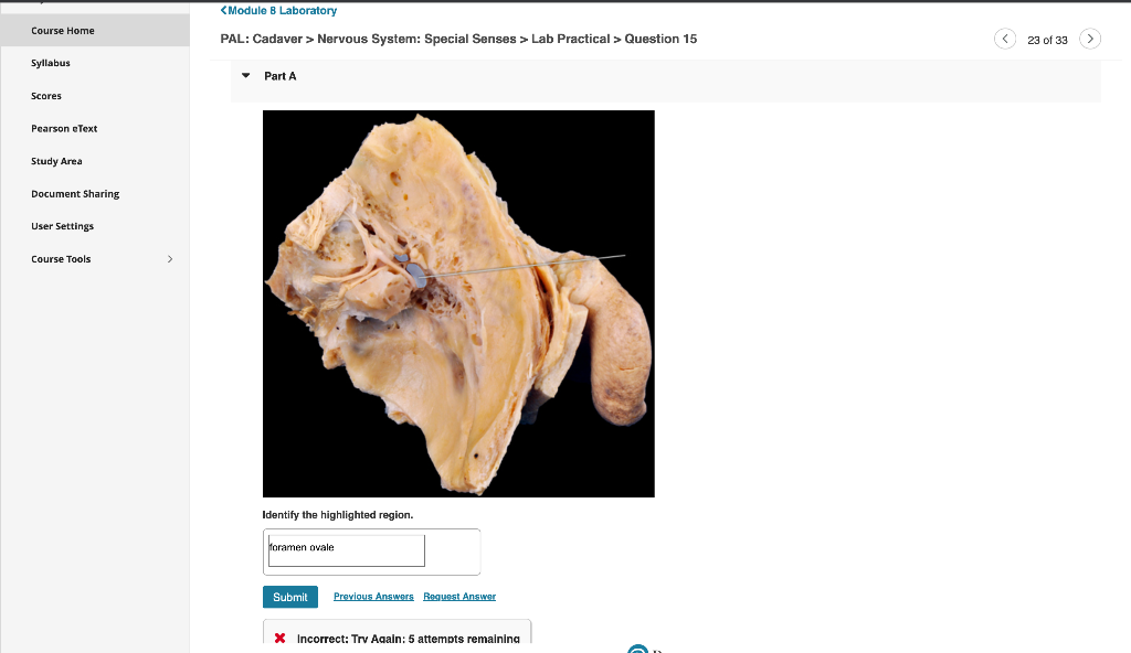 Solved PAL: Cadaver > Nervous System: Special Senses > Lab | Chegg.com