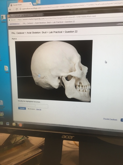 Solved 142401398OpenVellumHMA 72e4661 | Chegg.com