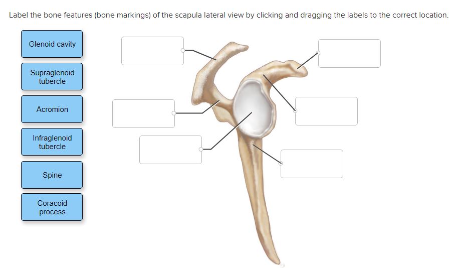 Solved Label the bone features (bone markings) of the | Chegg.com
