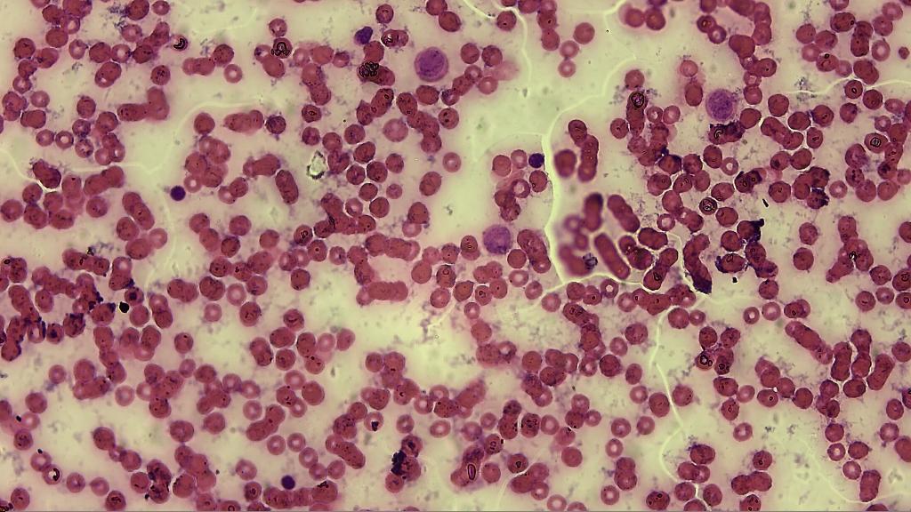 Solved Calculate the Differential White Blood Cell | Chegg.com