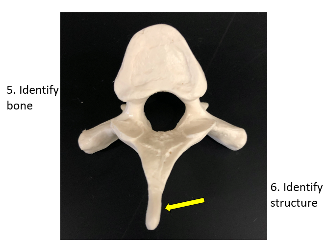 Solved 5. Identify bone 6. Identify structure | Chegg.com