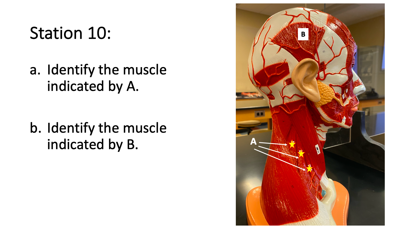 Solved Station 10: B a. Identify the muscle indicated by A. | Chegg.com