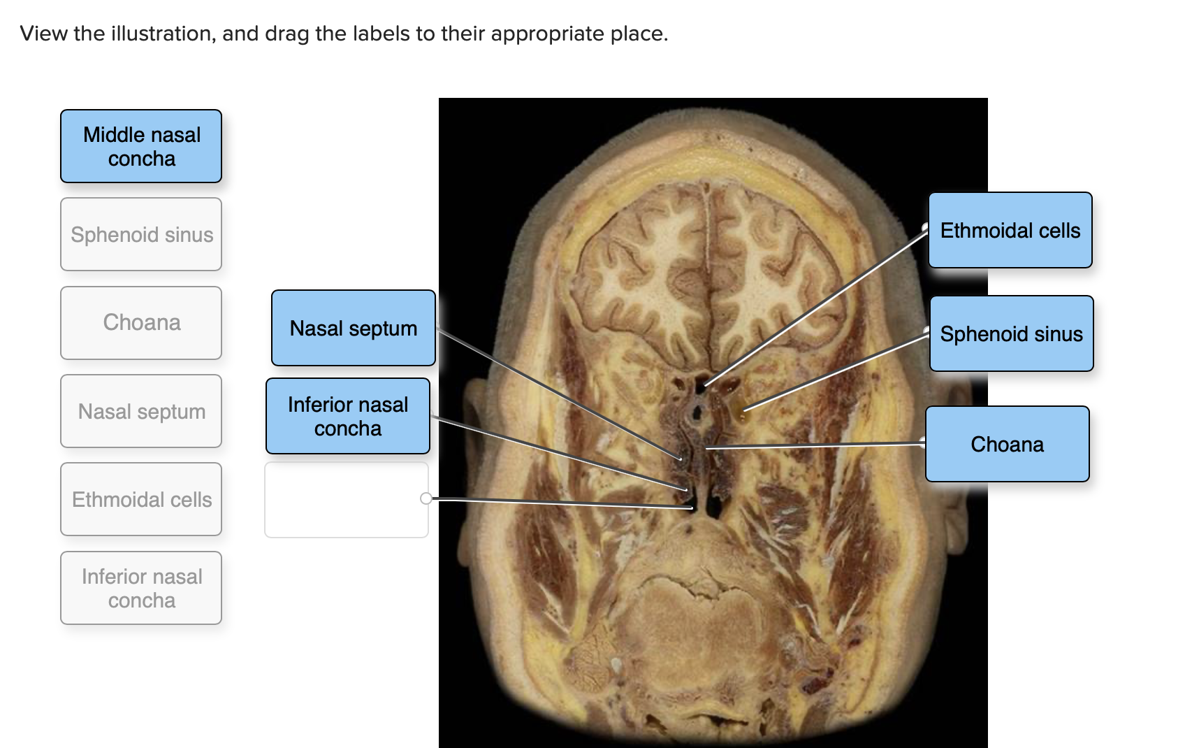 Solved View the illustration, and drag the labels to their | Chegg.com