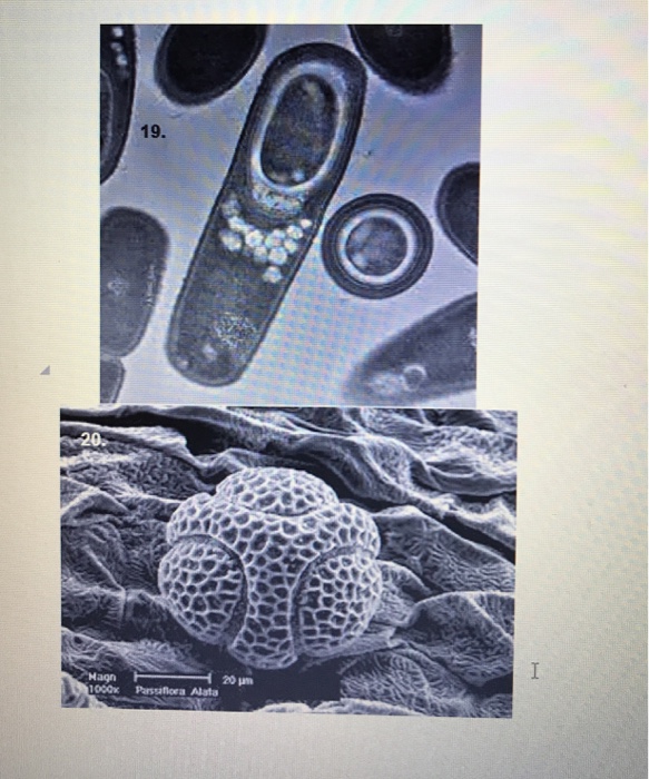 Solved What type of microscope was used to produce these | Chegg.com