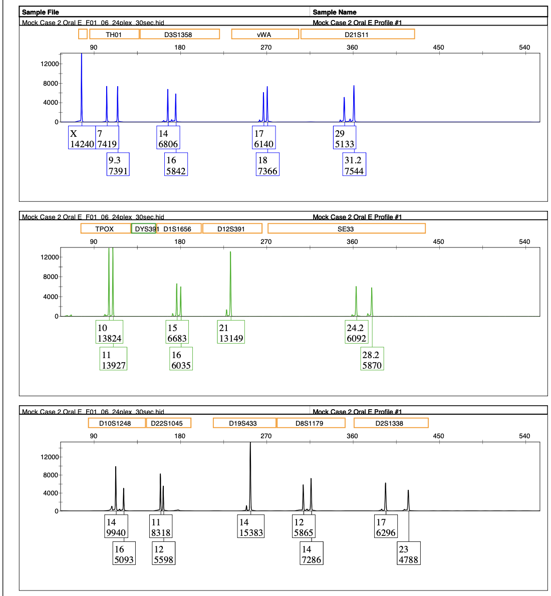 Solved Examine the Amelogenin locus and indicate if the DNA | Chegg.com