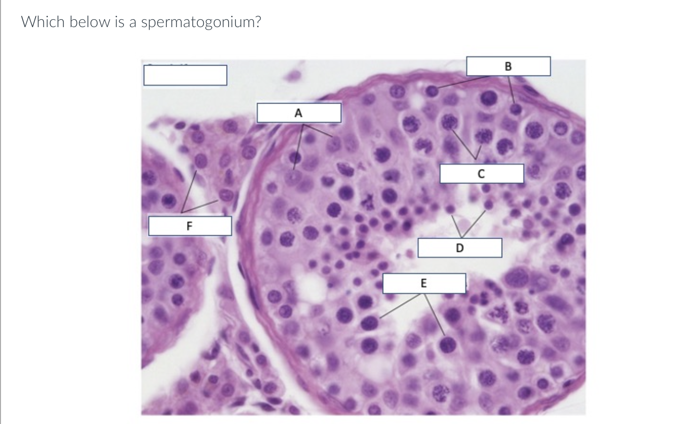 Solved Which below is a spermatogonium? | Chegg.com