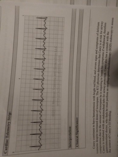 Solved Cardiac Telemetry Strip: Interpretation: Clinical | Chegg.com