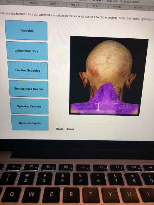 Solved Which structure is highlighted? masseter O platysma O | Chegg.com