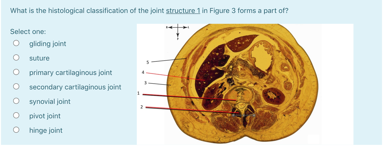 Solved What is the histological classification of the joint | Chegg.com