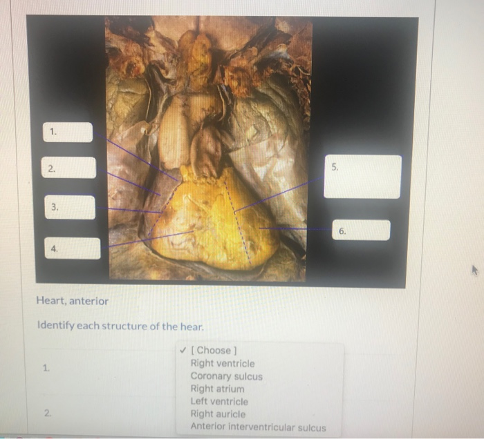 Solved Heart, anterior Identify each structure of the hear. | Chegg.com