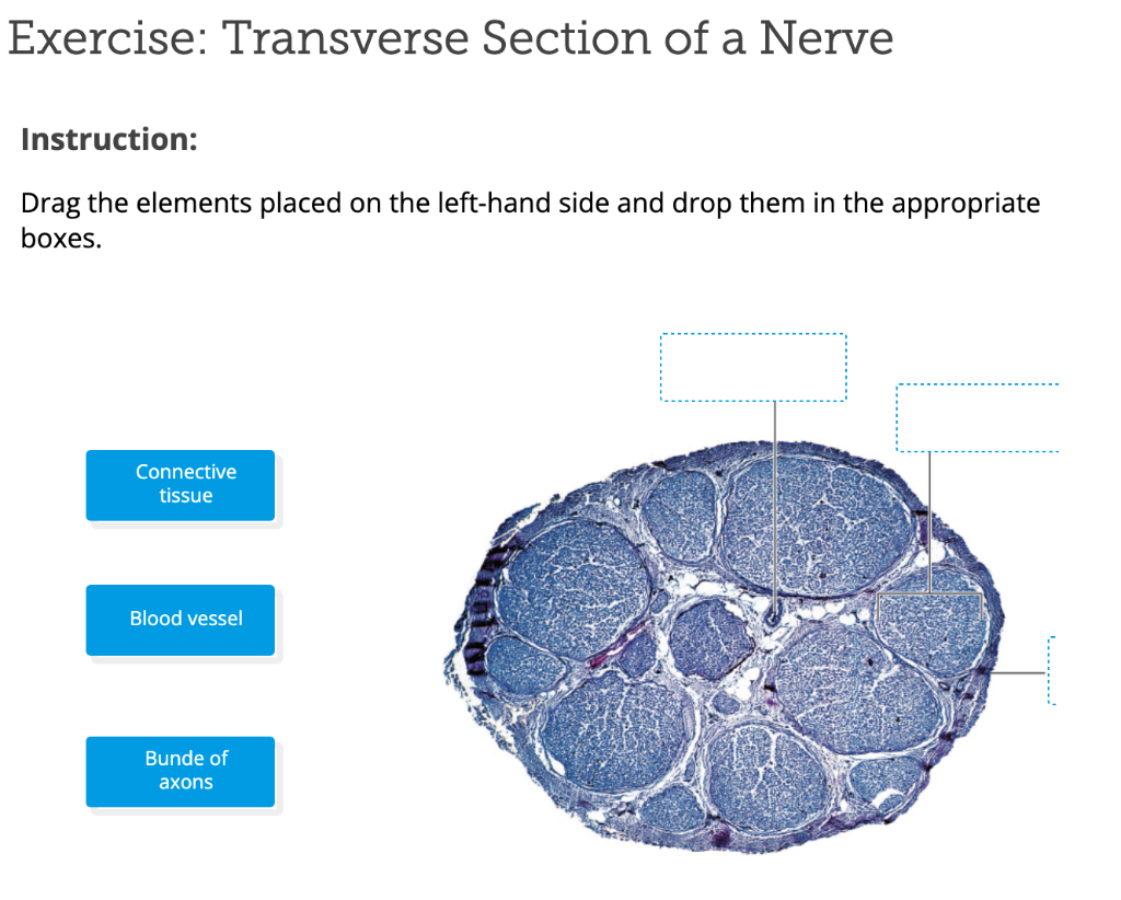 Solved Exercise: Transverse Section of a Nerve Instruction: | Chegg.com
