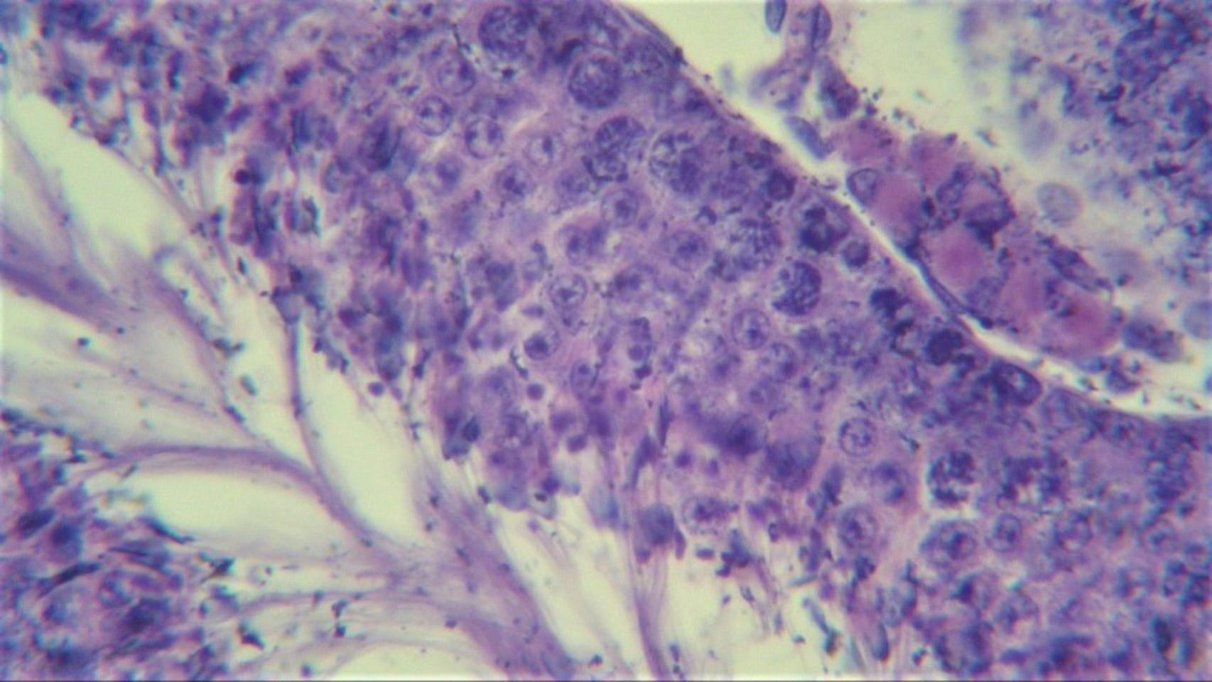 Solved Label the: 1. Lumen 2. Sertoli Cell 3. Spermatozoa 4. | Chegg.com