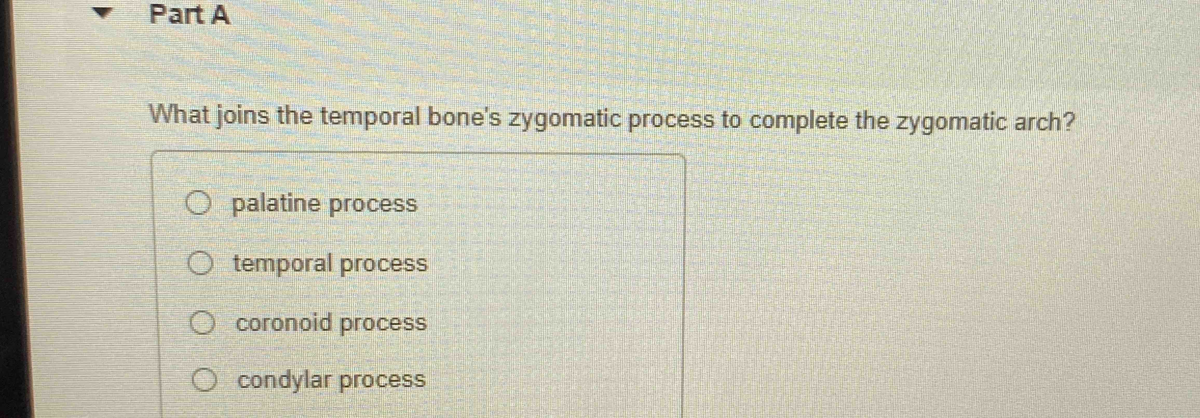 Solved Part AWhat joins the temporal bone's zygomatic | Chegg.com