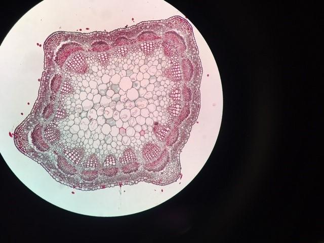 Solved 1.) Medicago (Alfalfa) stem, 100x mag., showing | Chegg.com