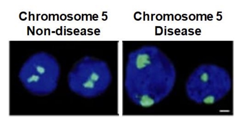 Solved In a human disease it has been observed that | Chegg.com