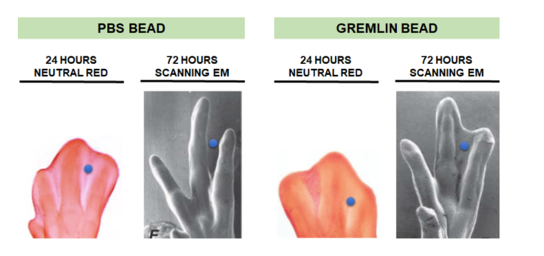 Solved The role of BMP signalling in interdigital cell death | Chegg.com