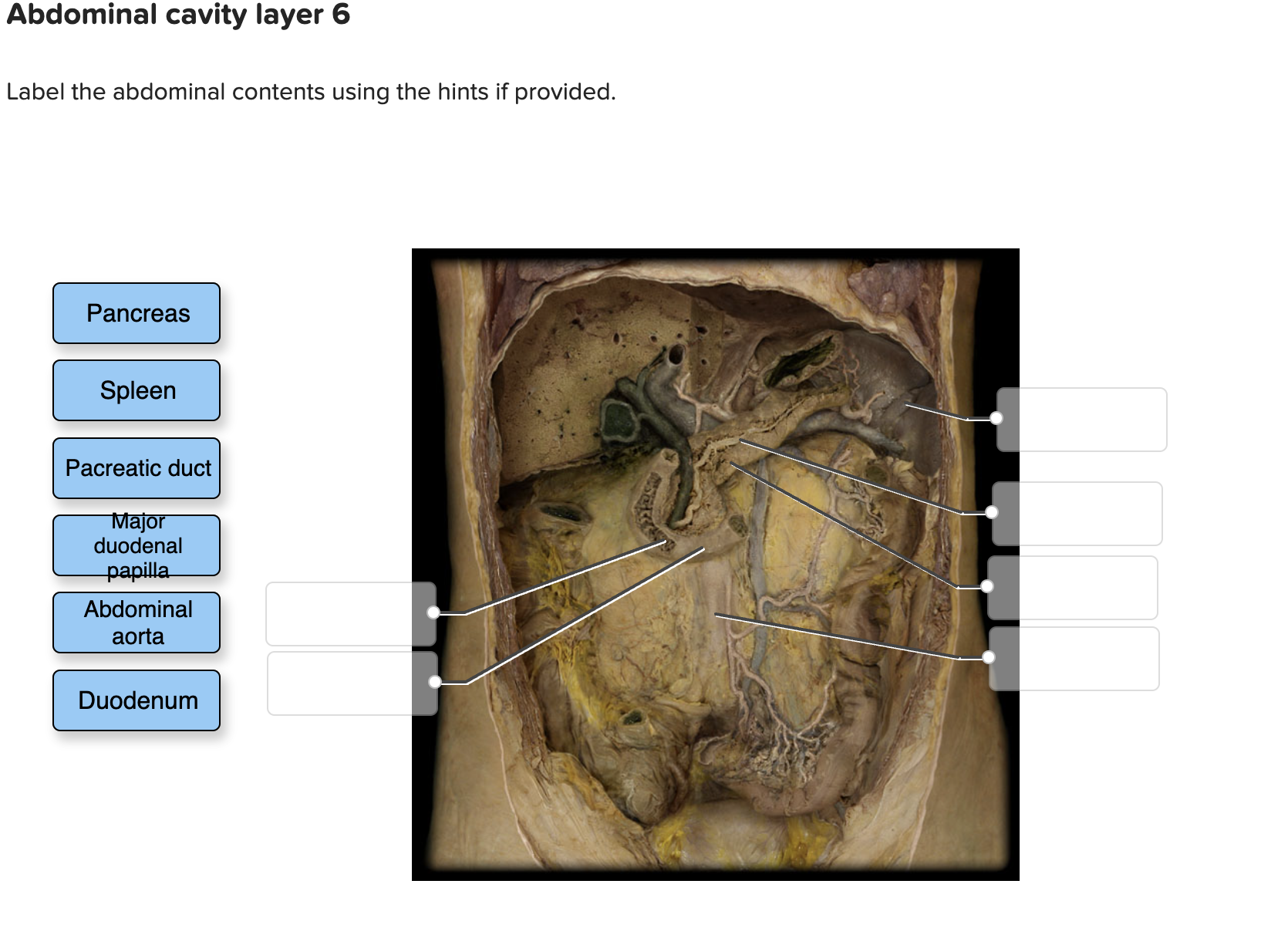 Solved Abdominal cavity layer 6Label the abdominal contents | Chegg.com