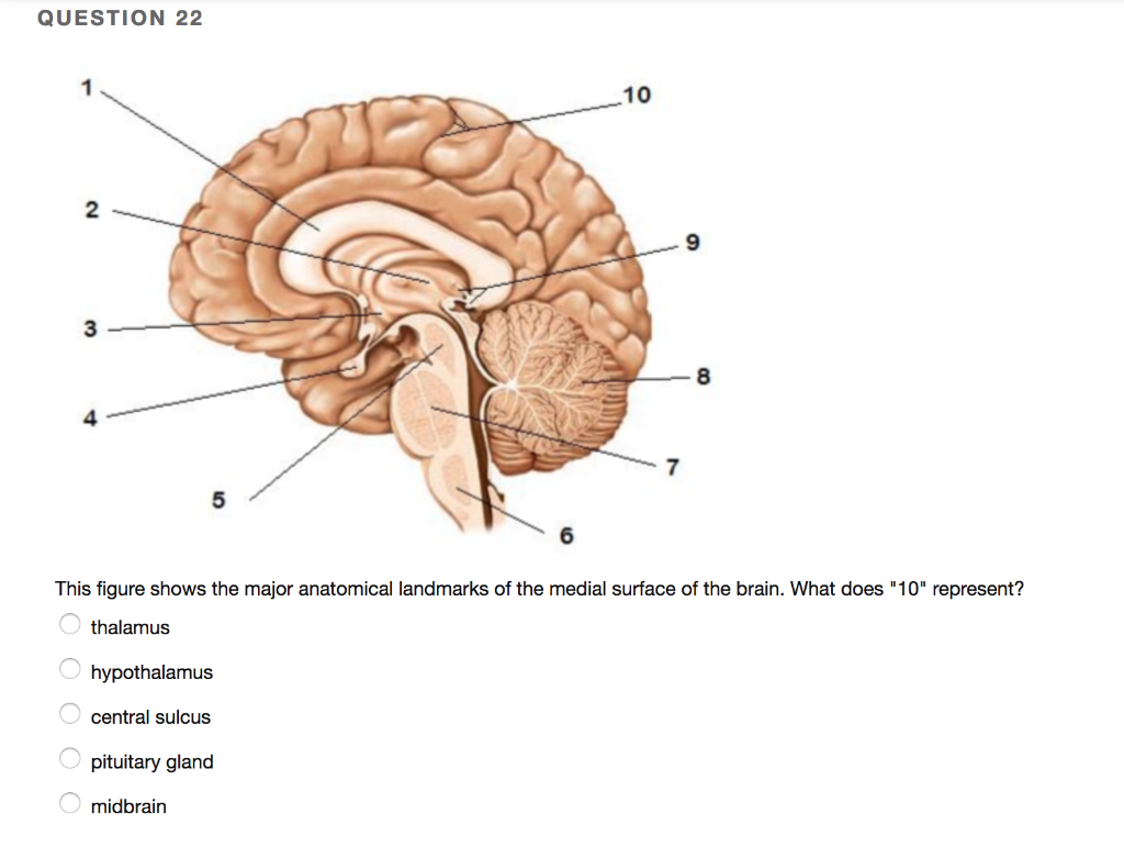 Solved QUESTION 22 10 2 9 3 8 4 7 5 6 This figure shows the | Chegg.com