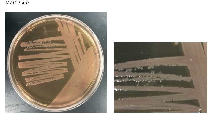 Solved Find the unknown bacteria here using two tests and | Chegg.com