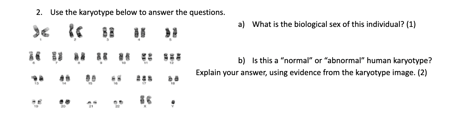 Solved 2. Use the karyotype below to answer the questions. | Chegg.com