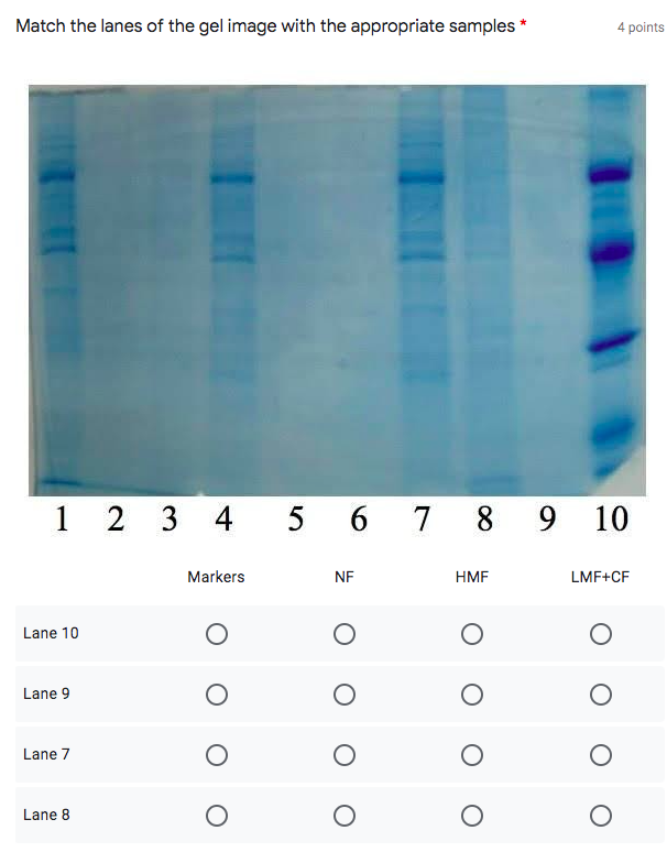 Solved Match the lanes of the gel image with the appropriate | Chegg.com