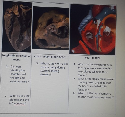 Solved Cross section of the heart: Heart model: Longitudinal | Chegg.com