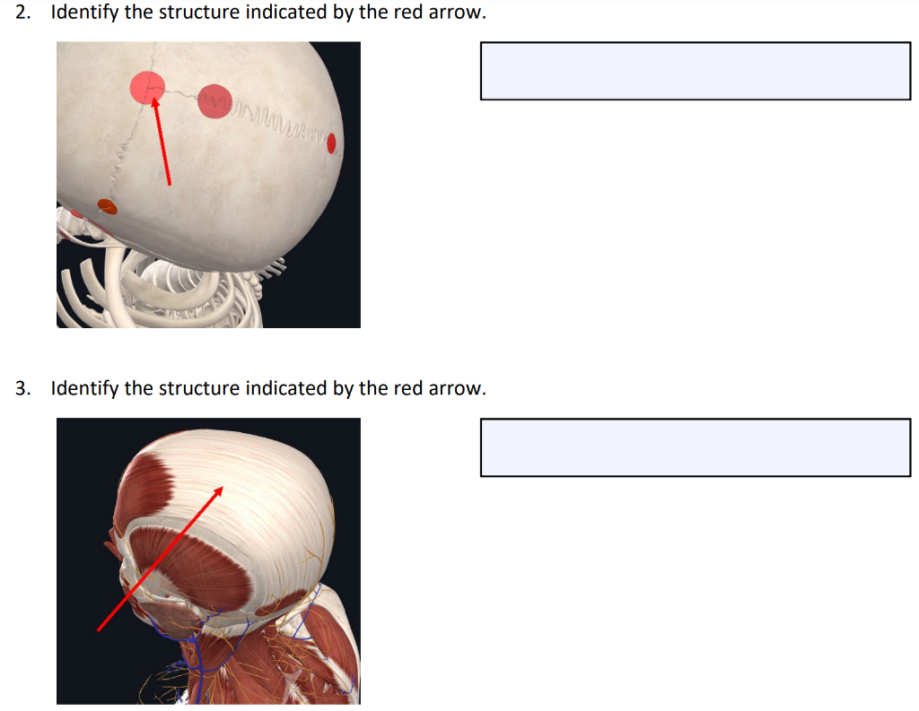 Solved 2. Identify the structure indicated by the red arrow. | Chegg.com