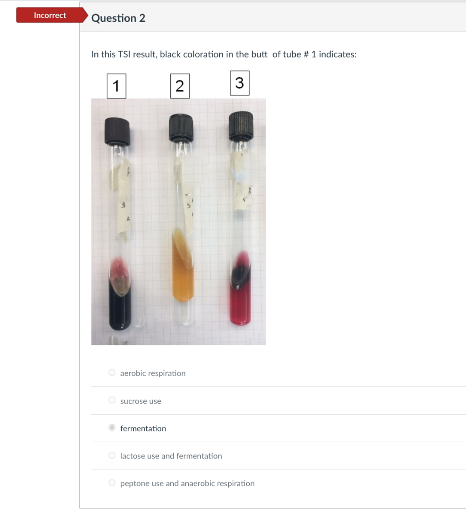 Solved Incorrect Question 2 In this TSI result, black | Chegg.com