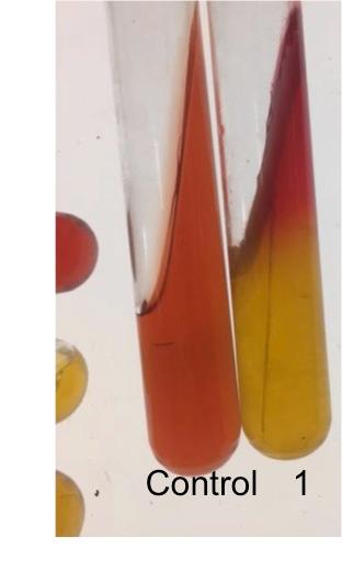 Solved For tube 1, describe the results of the Kligler test. | Chegg.com