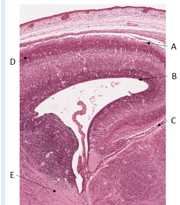 Solved This is a sagittal section of a newborn mouse brain. | Chegg.com