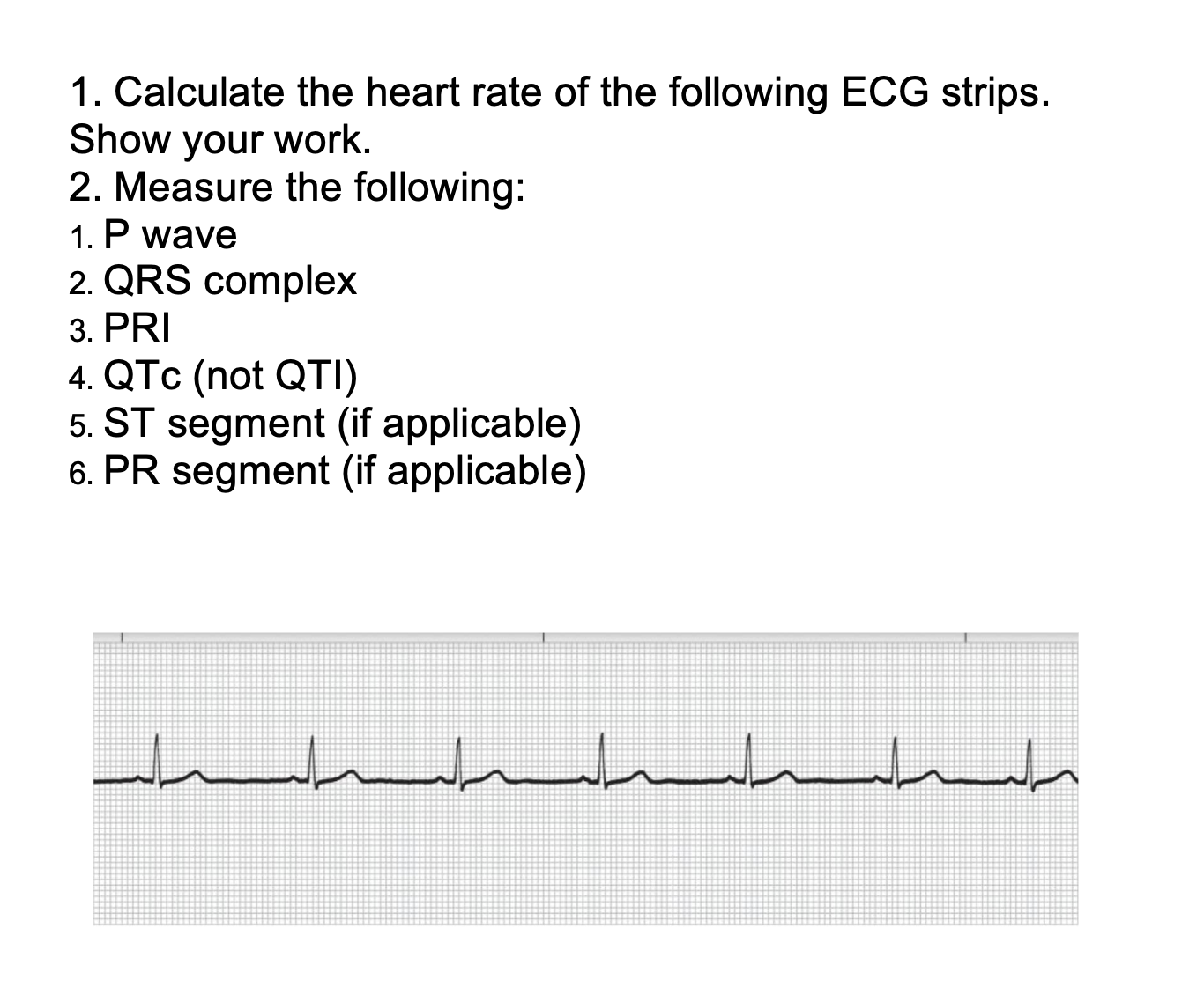 Solved 1. ﻿Calculate the heart rate of the following ECG | Chegg.com