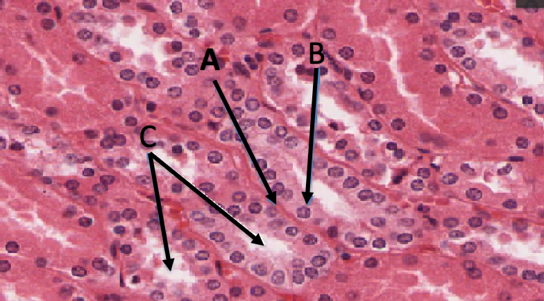 Solved SPECIFIC TISSUE TYPE: Simple Cuboidal Epithelial | Chegg.com