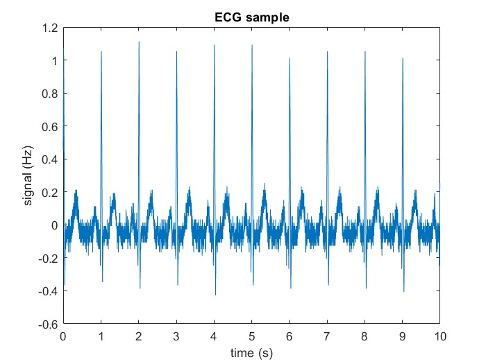 Solved I am trying to determine the beats per minute of ECG | Chegg.com