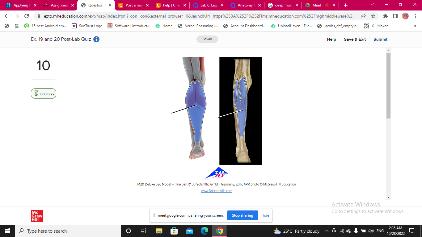 M20 Deluxe Leg Model - nine part @ 3B Sclentlfic | Chegg.com