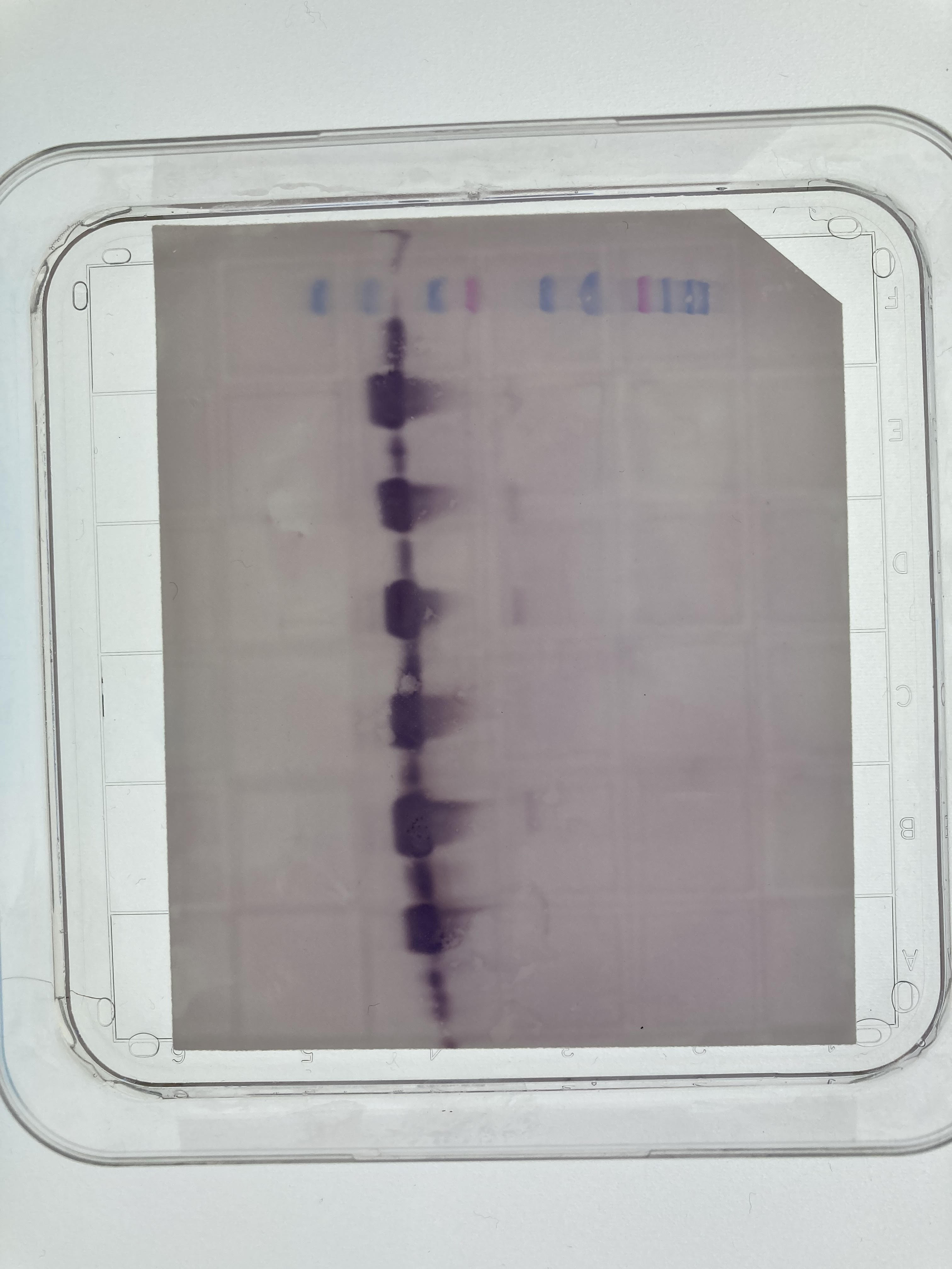 Solved Please interpret the results from this western blot. | Chegg.com
