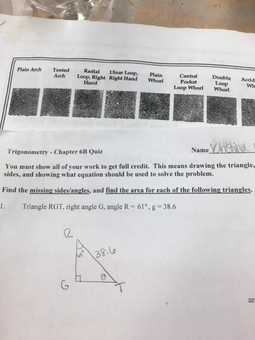 Solved Plain Arch Tented Radial Ulnar Loop, Plain Central | Chegg.com