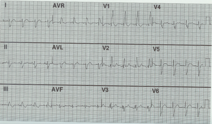 Solved 1. What is the rate and is it normal? A) Are the PR | Chegg.com
