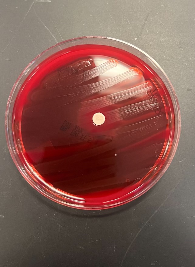 Solved I know that the strep above is positive for beta | Chegg.com
