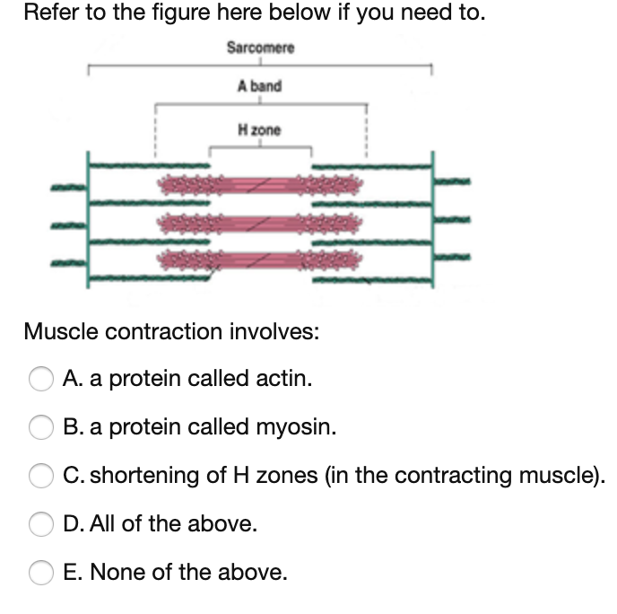 Solved Refer to the figure here below if you need to. | Chegg.com