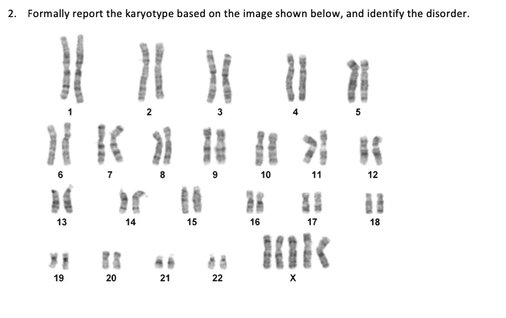 Solved 1. Formally report the karyotype based on the image | Chegg.com