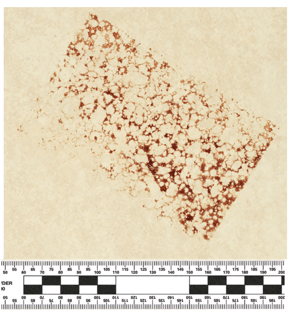 Solved Altered stain: A bloodstain with characteristics that | Chegg.com