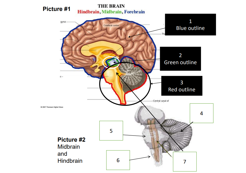 Solved THE BRAIN Picture #1 Hindbrain, Midbrain, | Chegg.com