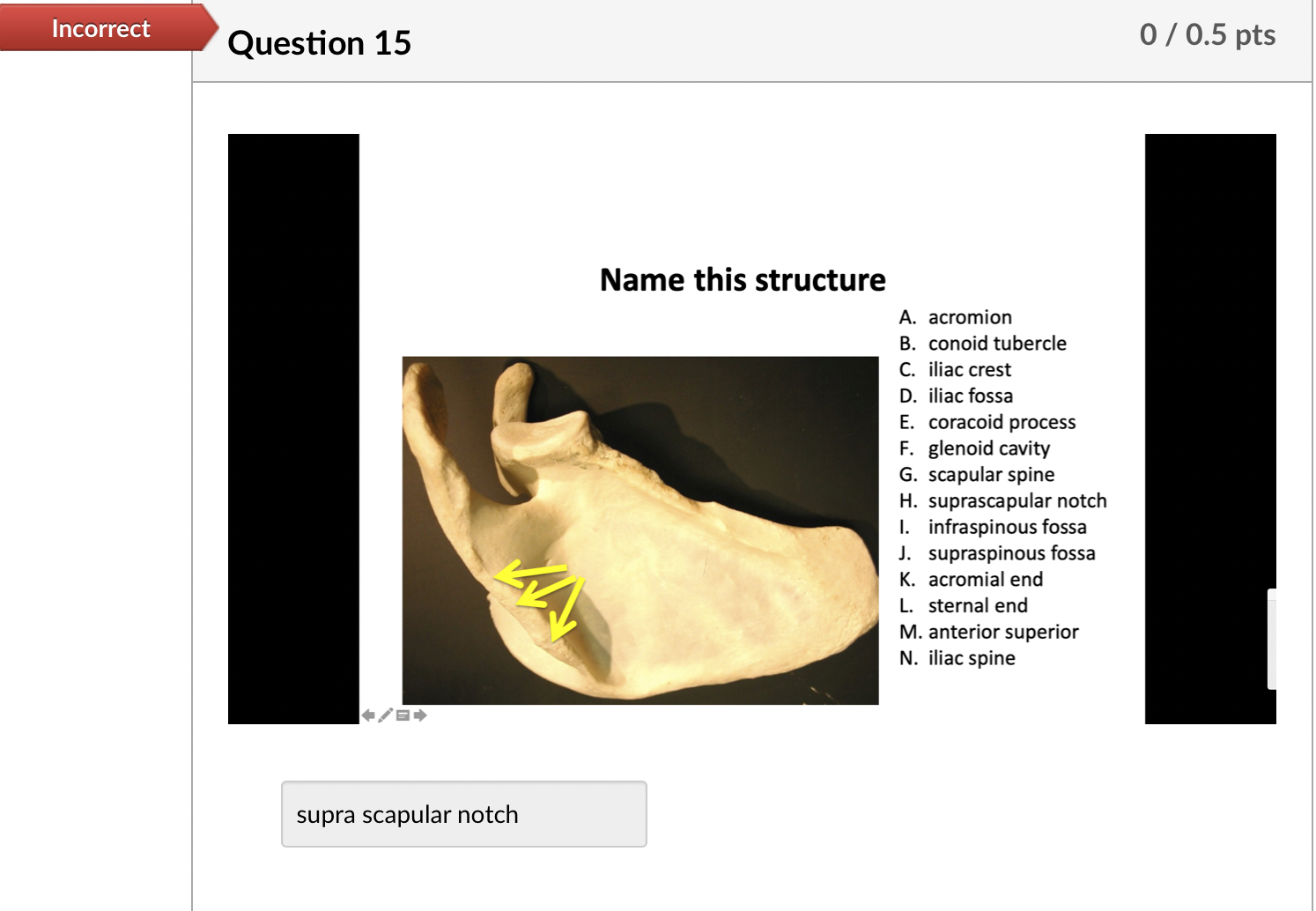 Solved Name this structure A. acromion B. conoid tubercle C. | Chegg.com