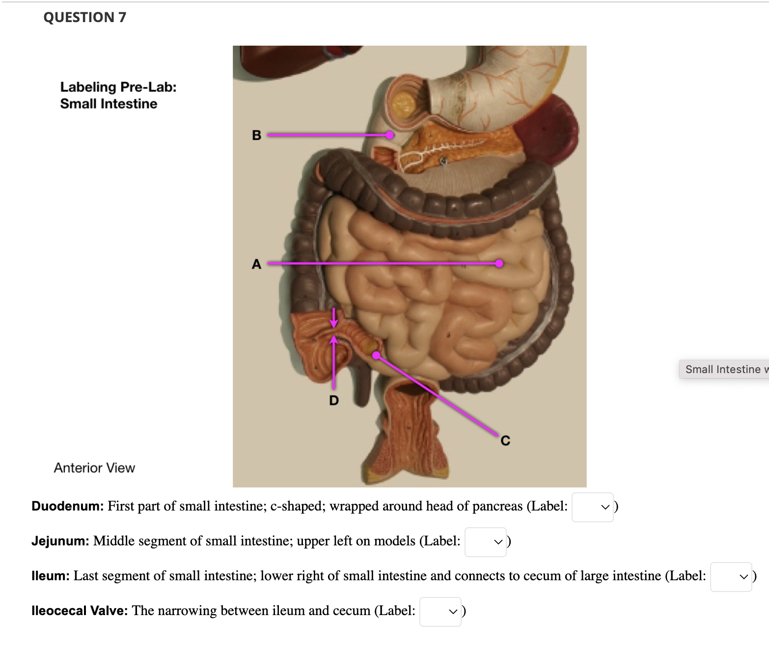 Solved Anterior View Lesser Curvature: Smaller curvature - | Chegg.com