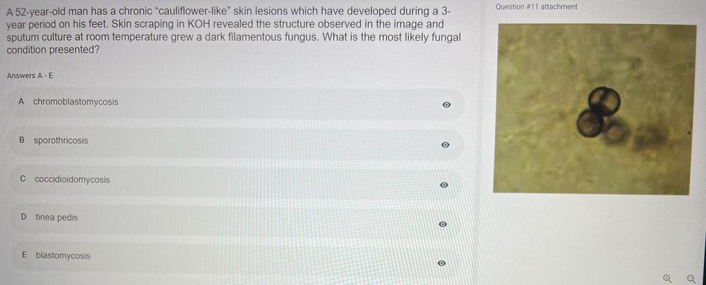 Solved A 52-year-old man has a chronic "cauliflower-like" | Chegg.com