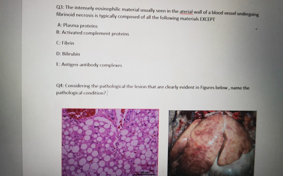 Solved Q1: Which of the endogenous pigments below | Chegg.com