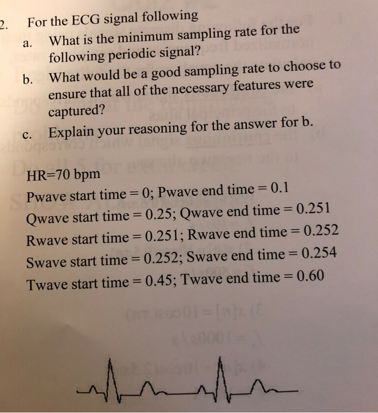 2. For the ECG signal following What is the minimum | Chegg.com